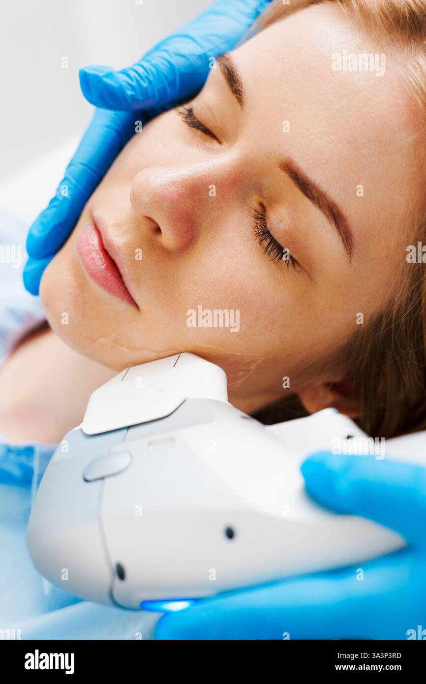 IPL laser acne treatment on woman' s face in the dermatology clinic ...