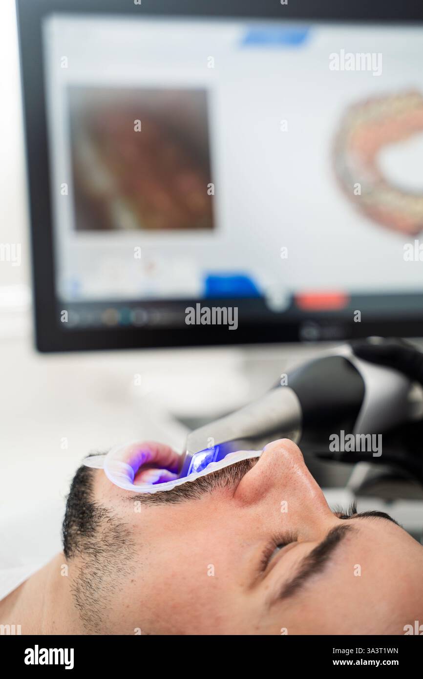 Dental 3d scanner applying process. Digital impressioning teeth of ...