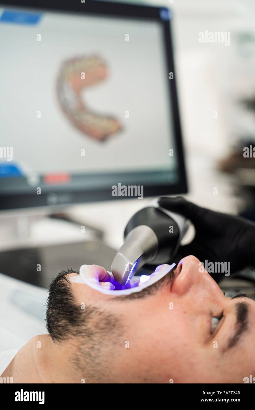 Dental intraoral scanner used by orthodontist in stomatology clinic ...