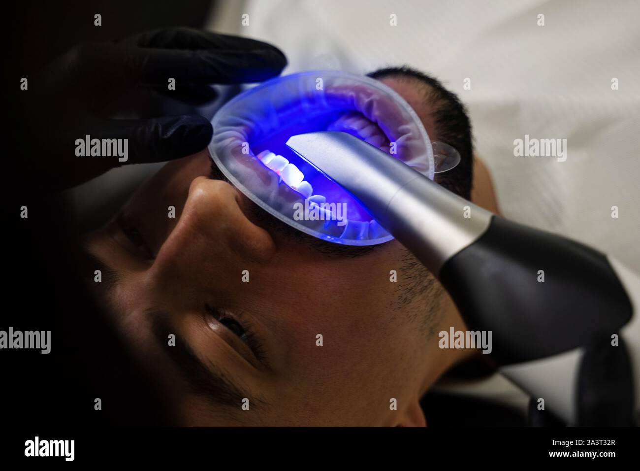 Digital teeth scanning process. Dentist uses dental scanner to examine ...