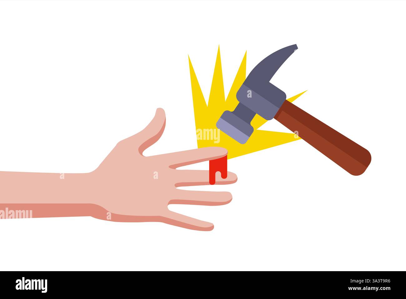 Hitting finger with hammer. Flat illustration Stock Vector Image & Art ...