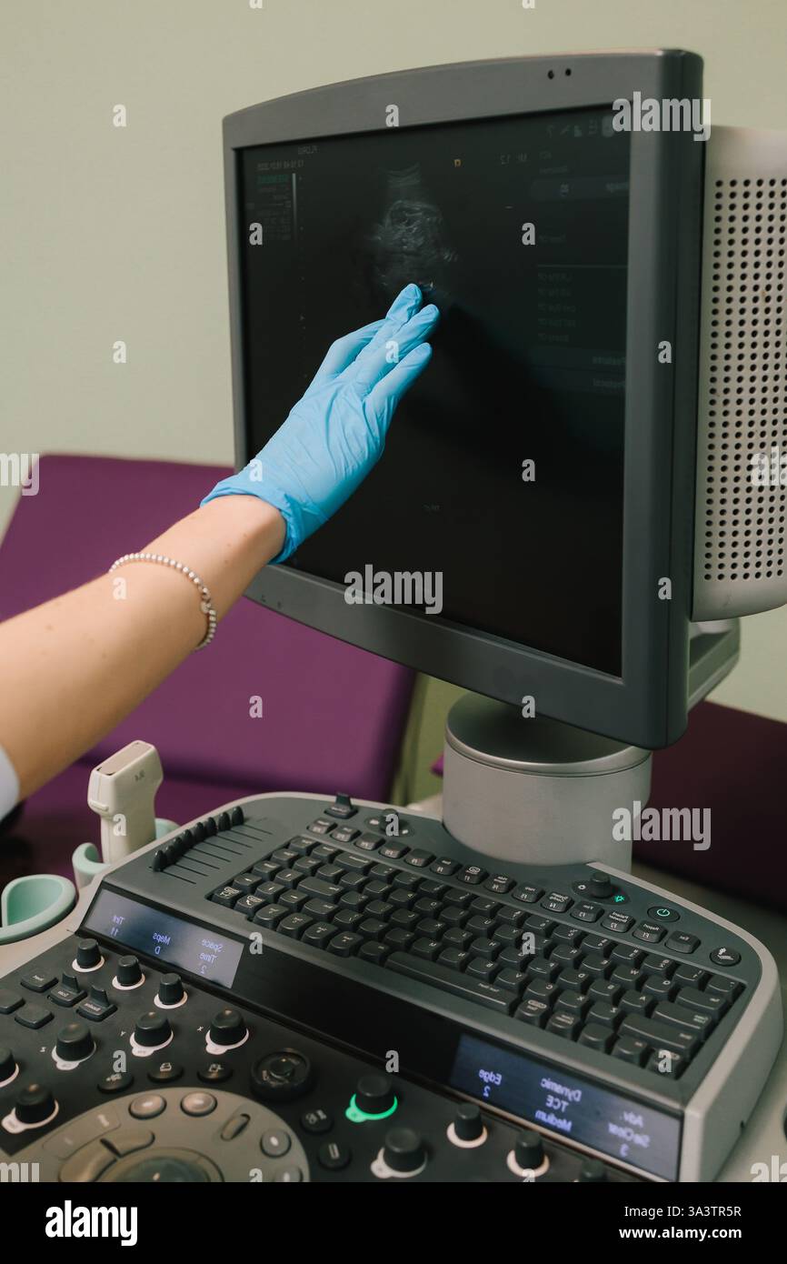 Checking fetus health at the gynecology hospital. Gynecologist uses ...