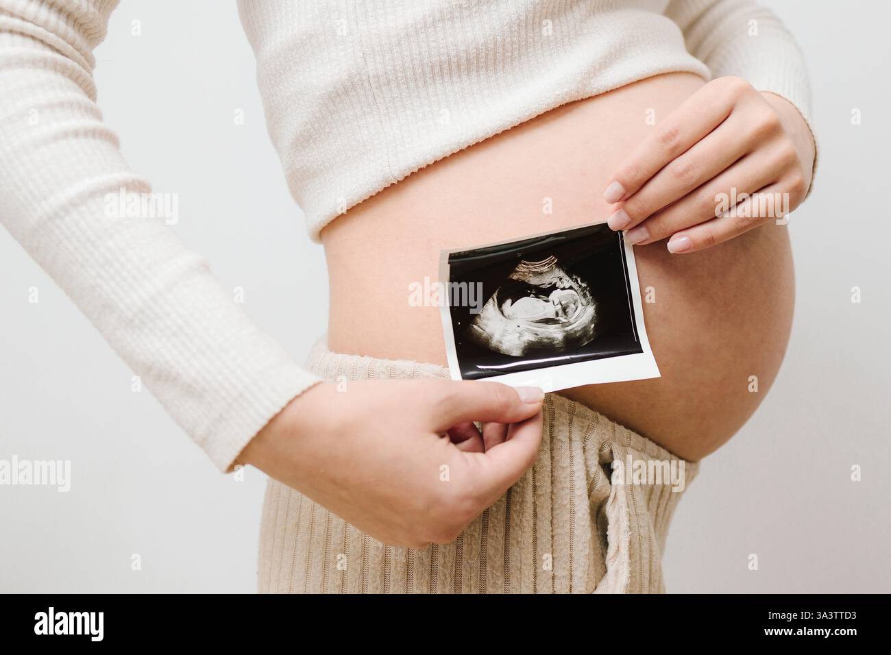 Happy expectant mom shows fetus ultrasound image after sonogram ...