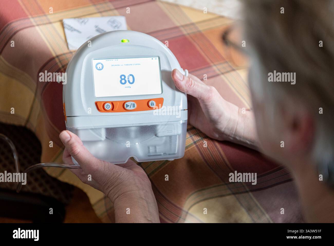 Wound vac hi-res stock photography and images - Alamy