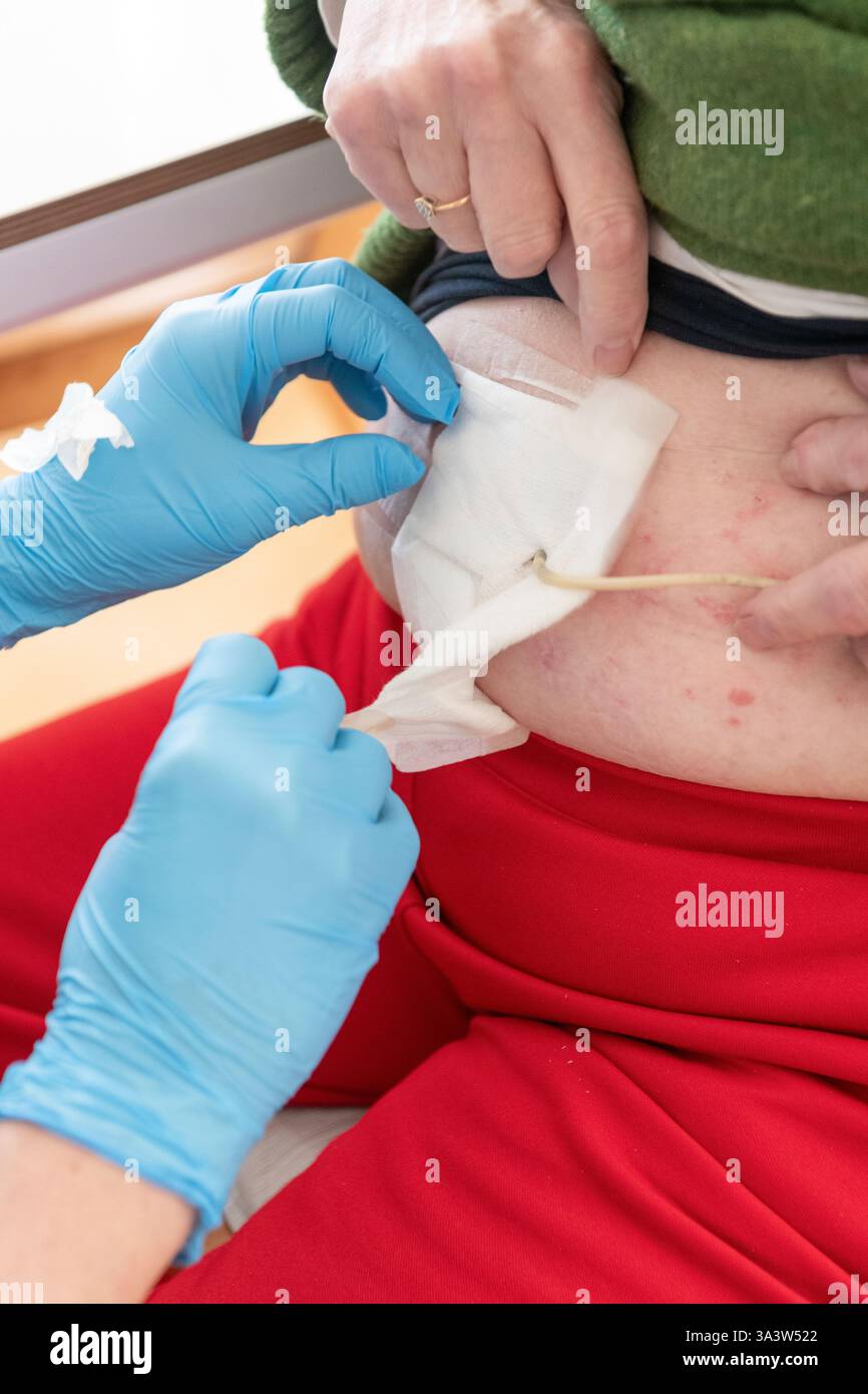 Homecare nurse treating wound Stock Photo - Alamy