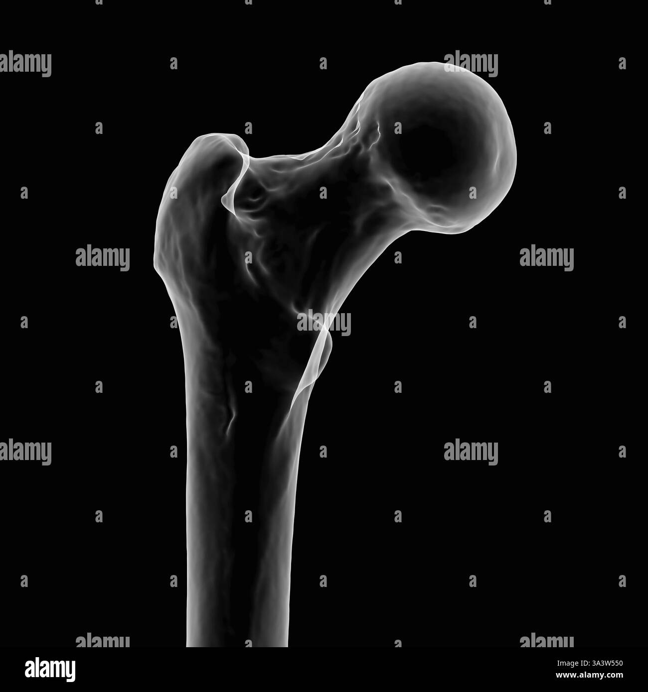 Illustration of the femur bone anatomy, showcasing the structure of the ...