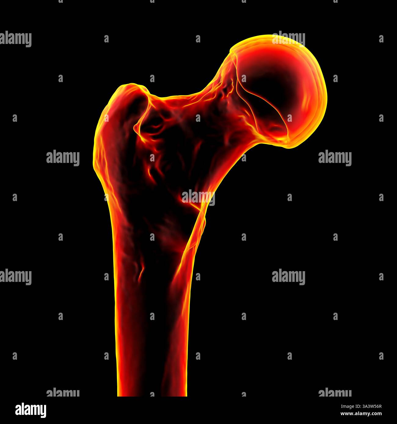 Illustration of the femur bone anatomy, showcasing the structure of the ...