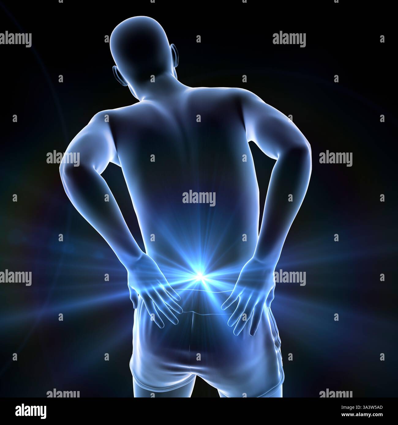Illustration of a person with lower back pain, emphasising the lumbar ...