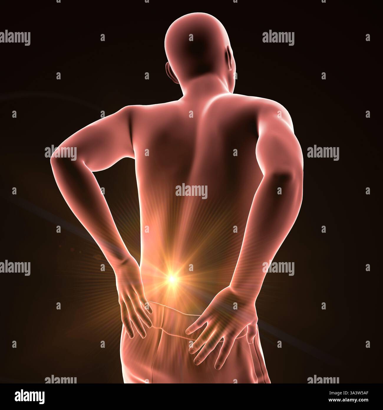 Illustration of a person with lower back pain, emphasising the lumbar region and depicting ...