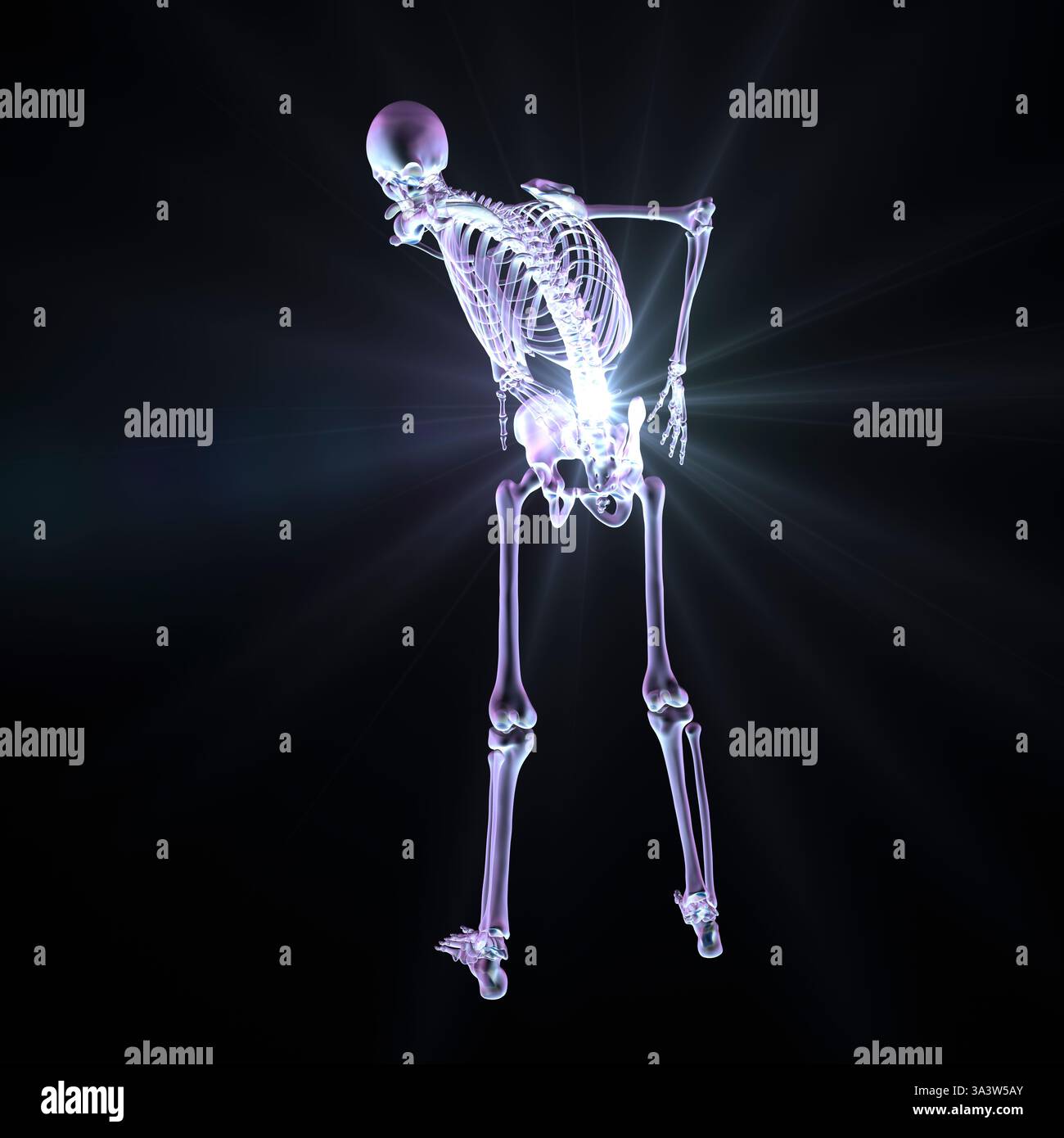 Illustration of a human skeleton with lower back pain, depicting spinal ...