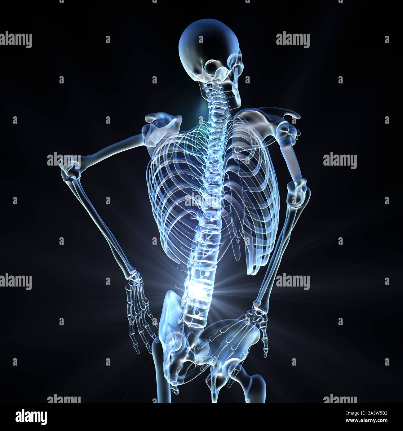 Illustration of a human skeleton with lower back pain, depicting spinal ...