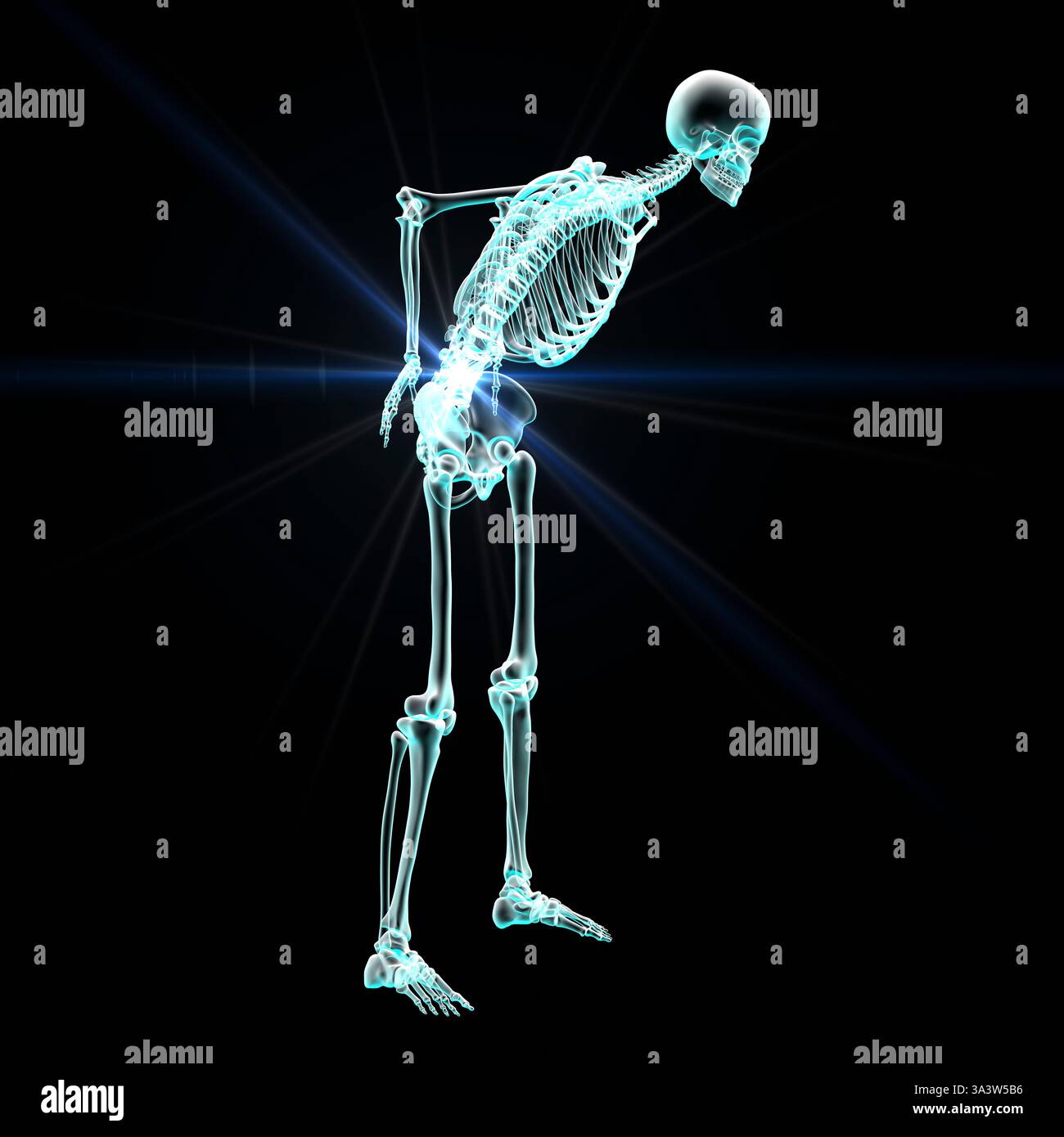 Illustration of a human skeleton with lower back pain, depicting spinal ...