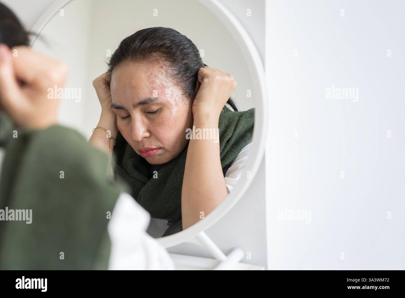 Beauty, health care from acne problem, dry skin, treatment. Anti ...