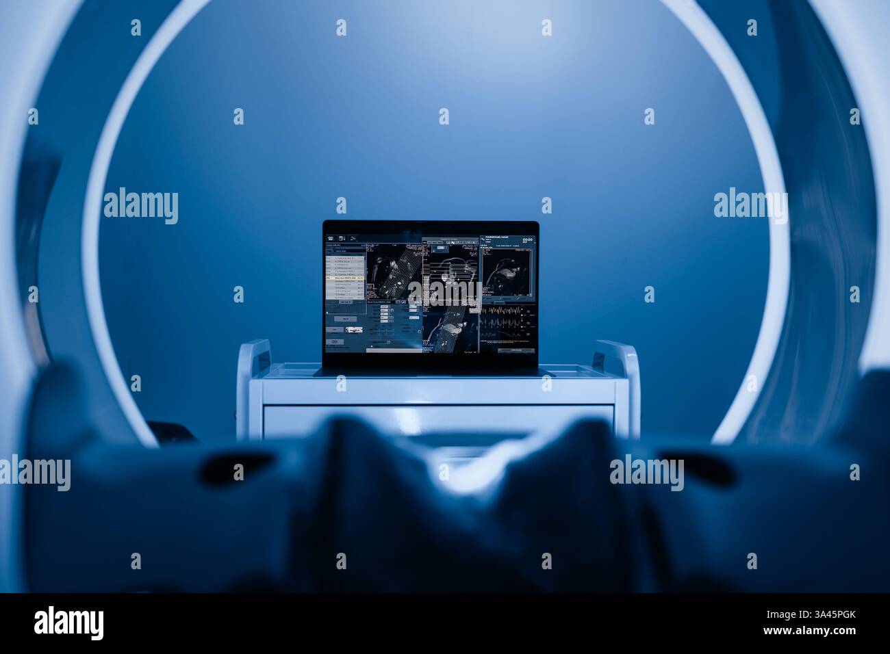 A screen displaying CT or MRI scan images against the backdrop of ...