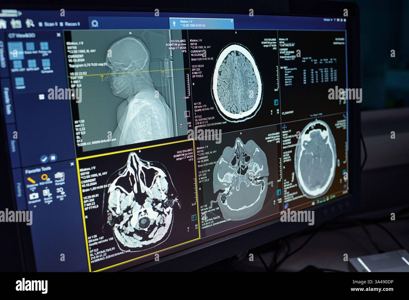 Multiple brain scans displayed on a high-resolution monitor in medical setting with detailed ...
