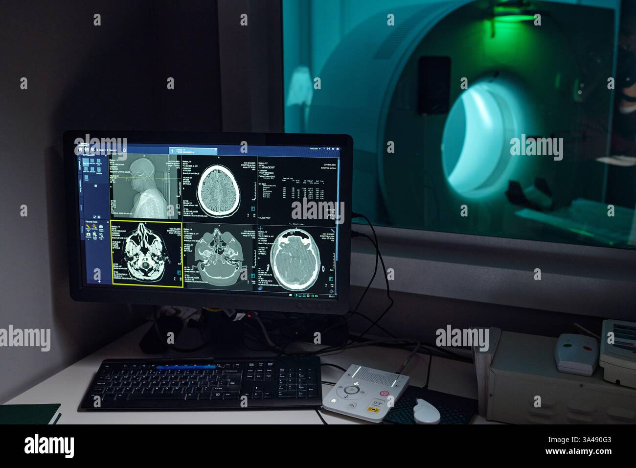 Medical room showing brain MRI scans on computer screen alongside MRI ...