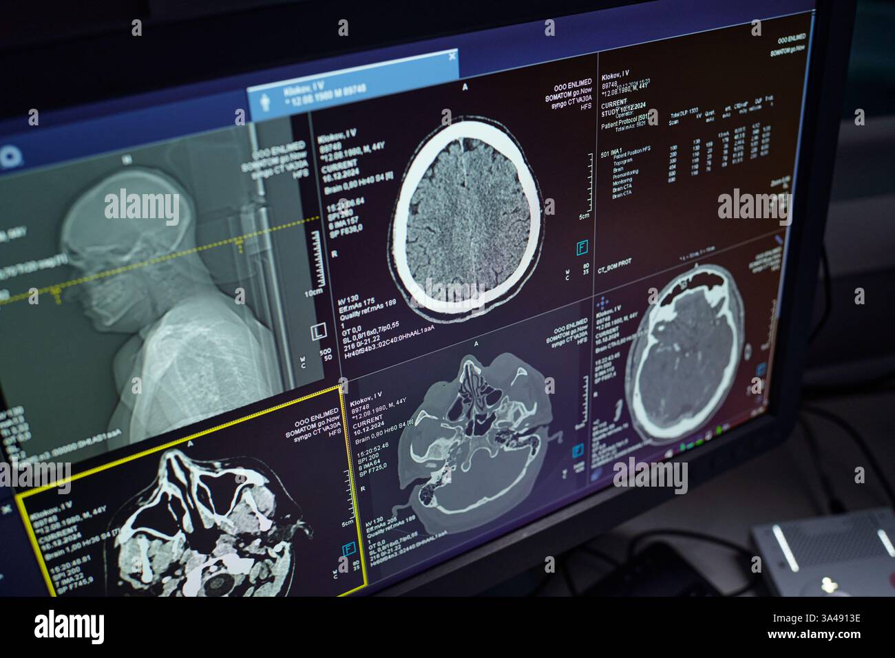 Images display various brain scans on computer screen in modern radiology lab, showing detailed ...