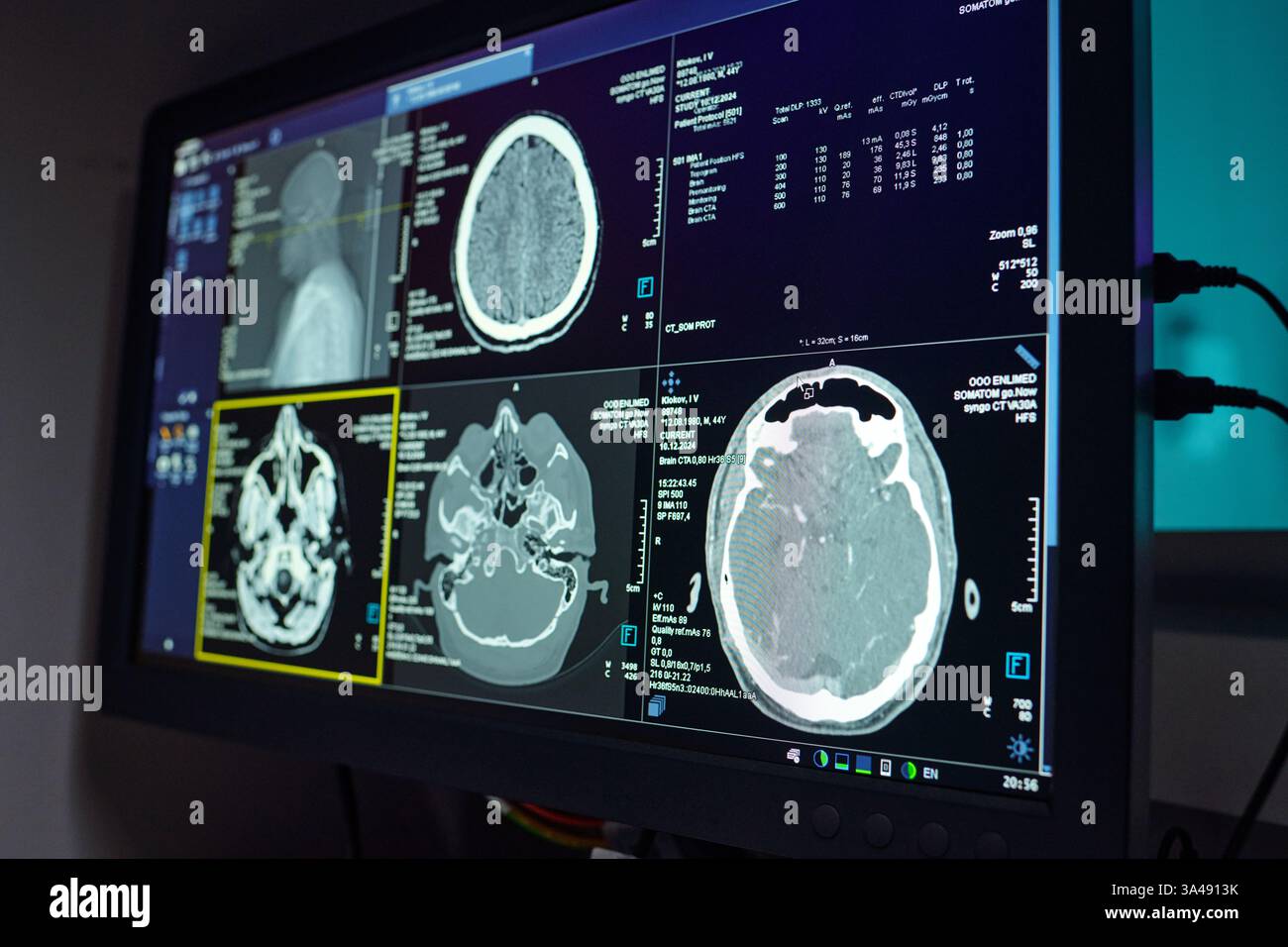Medical imaging results displayed on an advanced screen, showcasing detailed brain scans and ...