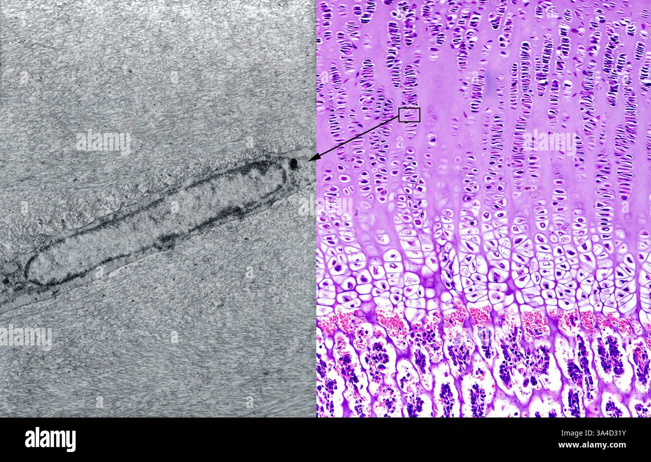 Bone growth plate, light micrograph and transmission electron ...