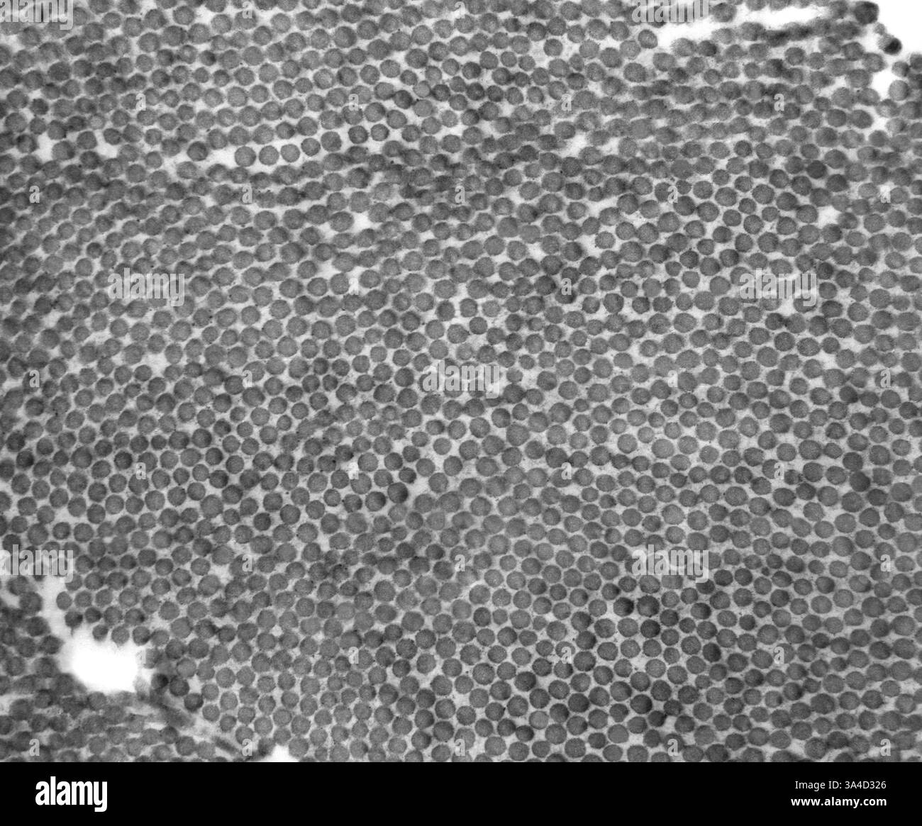 Transmission electron micrograph (TEM) of connective tissue showing ...