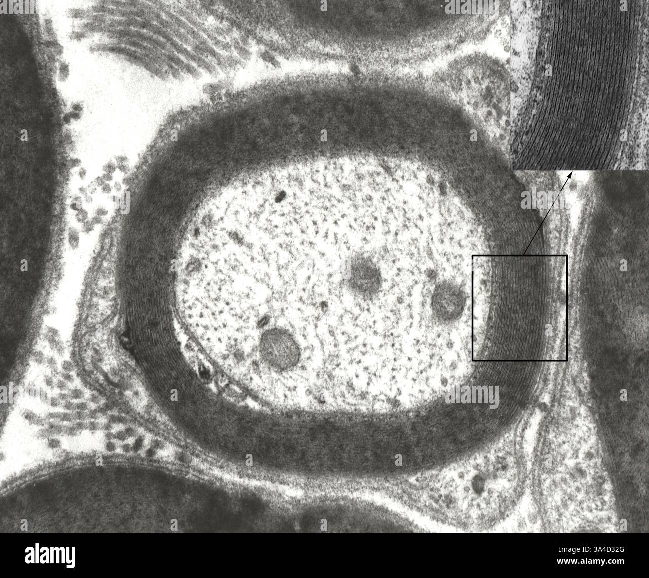 Coloured transmission electron micrograph (TEM) of a dorsal root ...