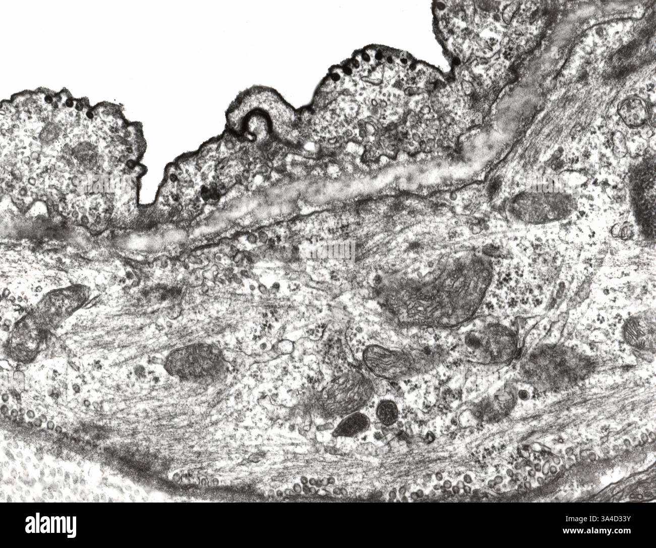 Transmission electron micrograph (TEM) of an arteriole showing, from ...