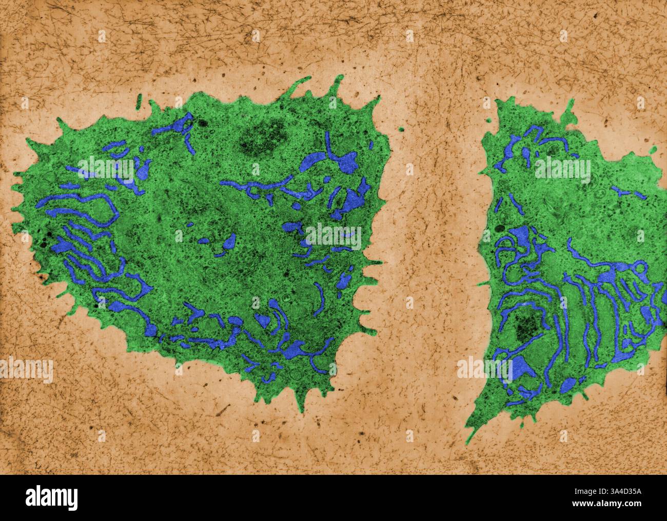 Coloured transmission electron micrograph (TEM) showing the rough ...