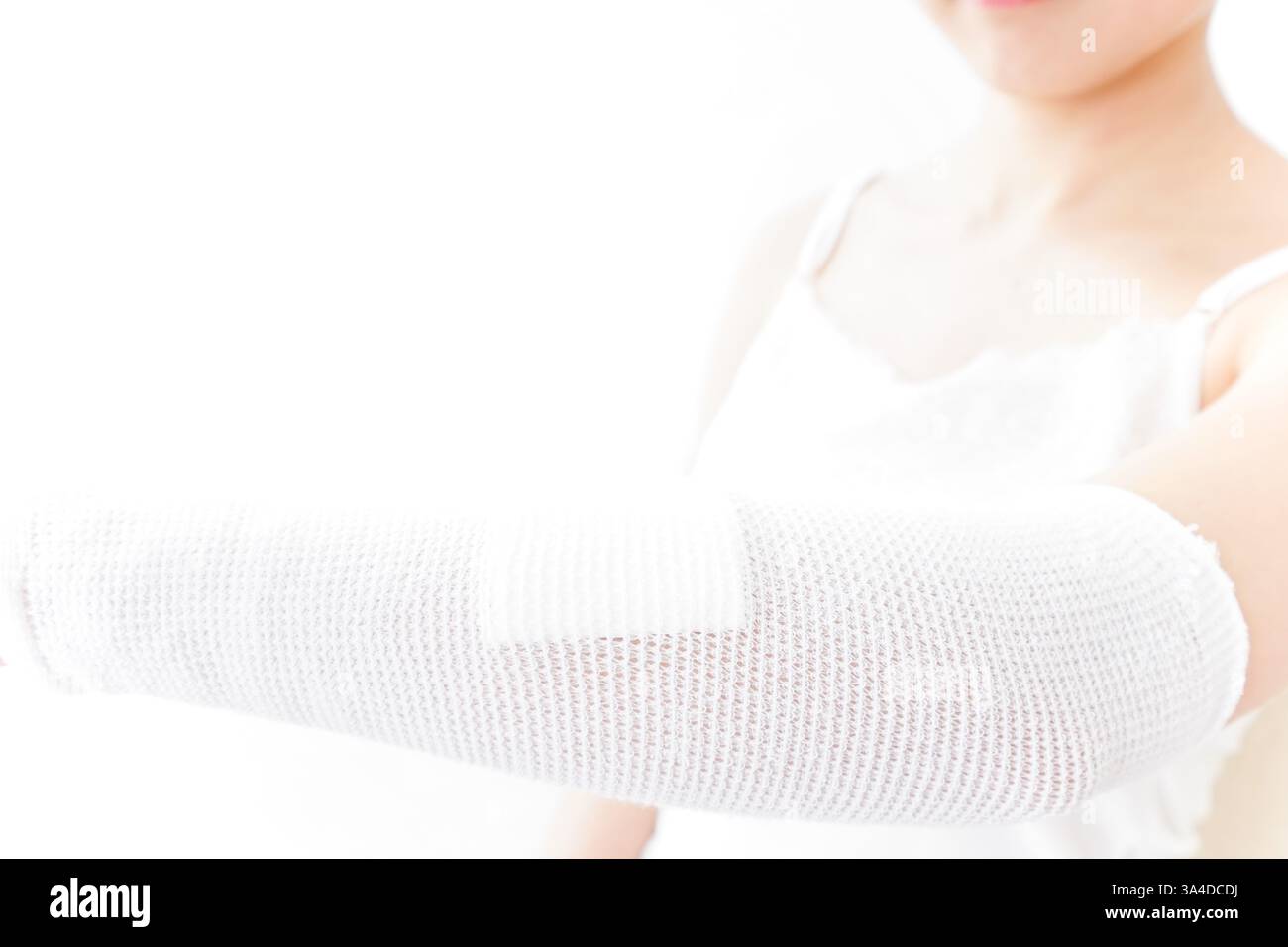 Woman with arm injury Stock Photo - Alamy