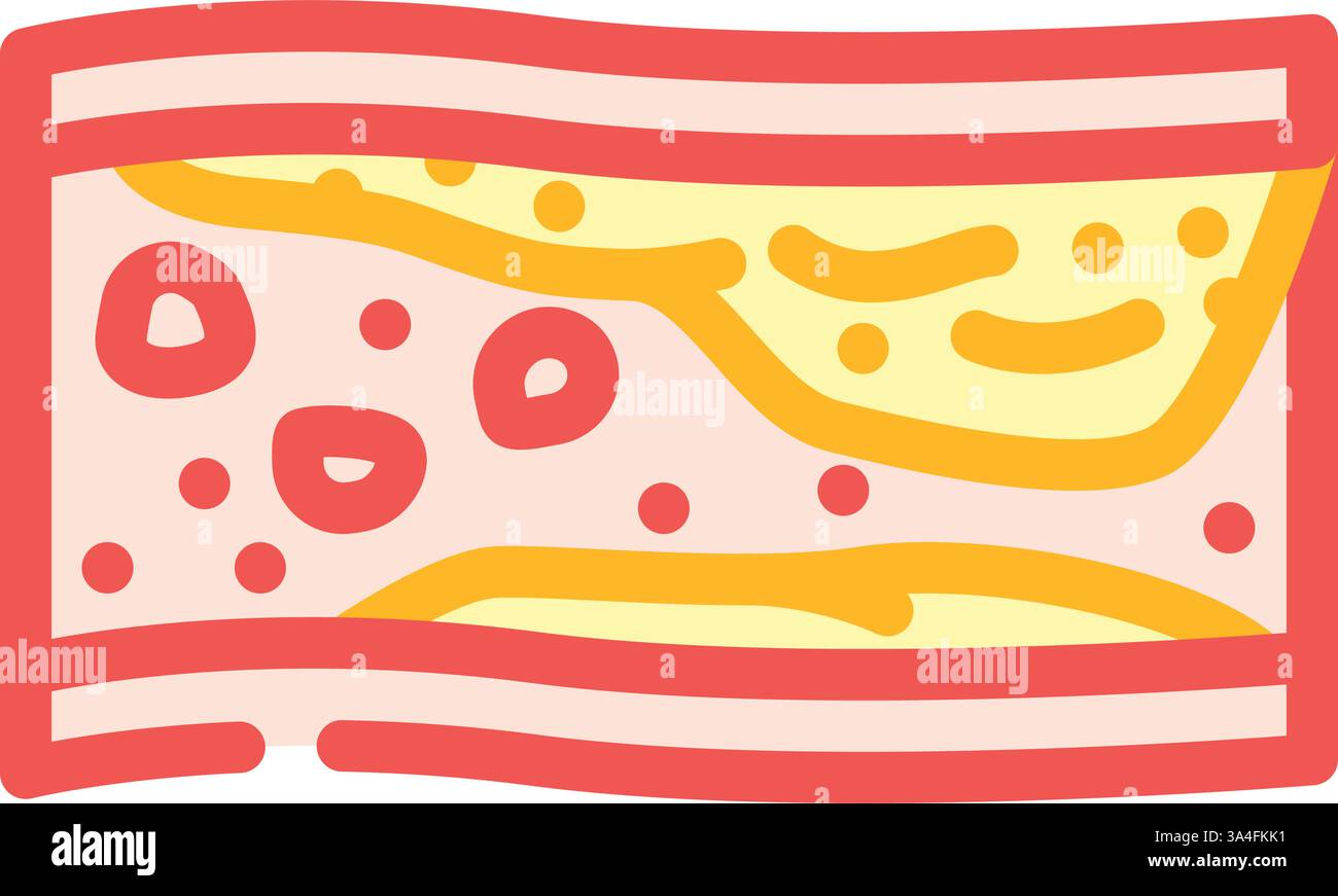 atherosclerosis cardiology disease color icon vector illustration Stock ...