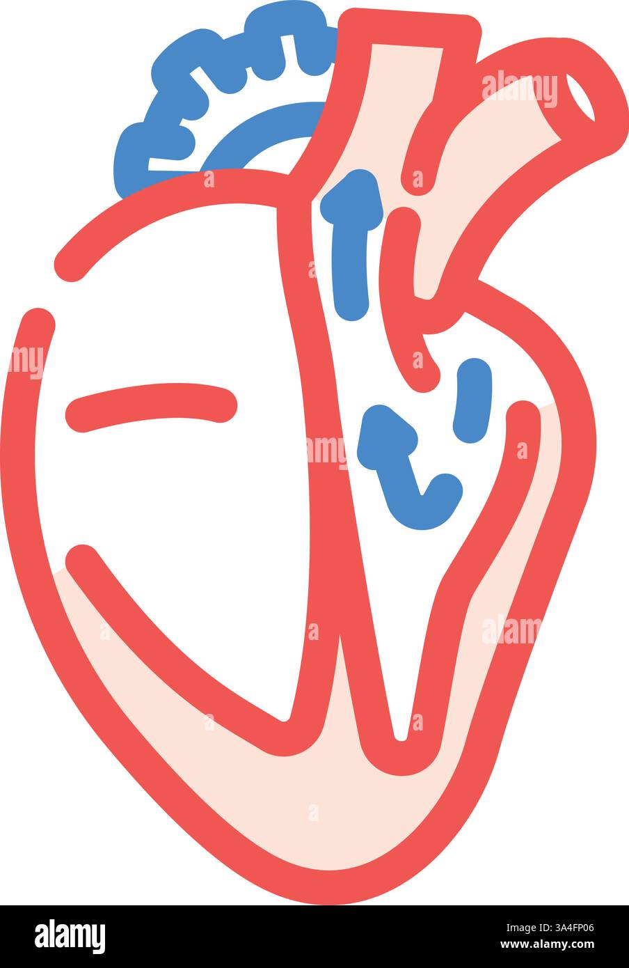 dilated cardiomyopathy cardiology disease color icon vector ...