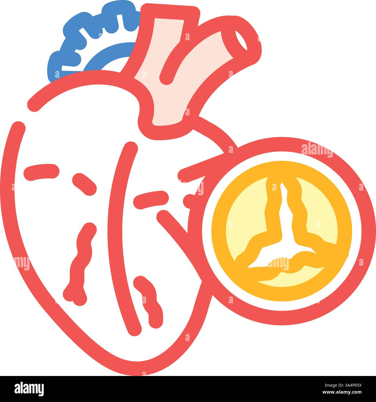 heart valve disease cardiology disease color icon vector illustration ...