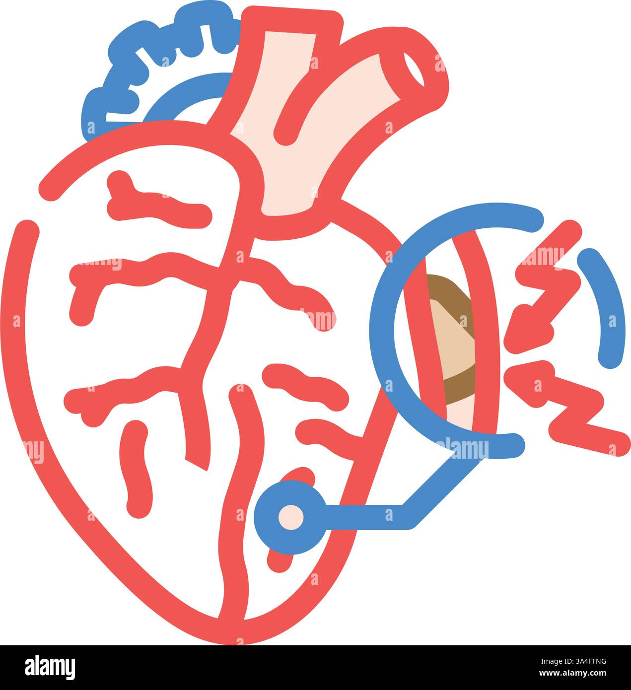 stroke caused cardiovascular issues color icon vector illustration ...