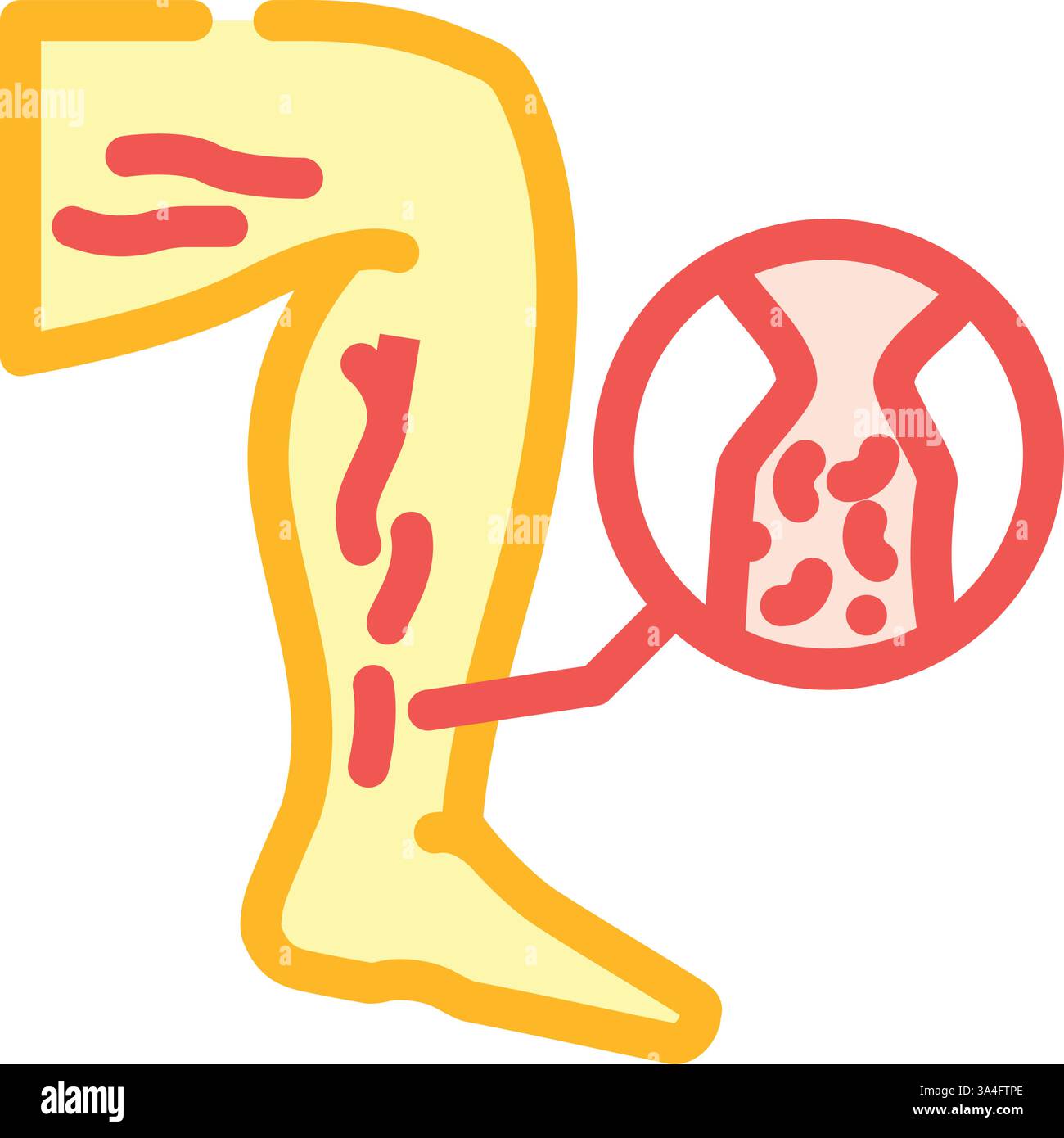 deep vein thrombosis cardiology disease color icon vector illustration ...
