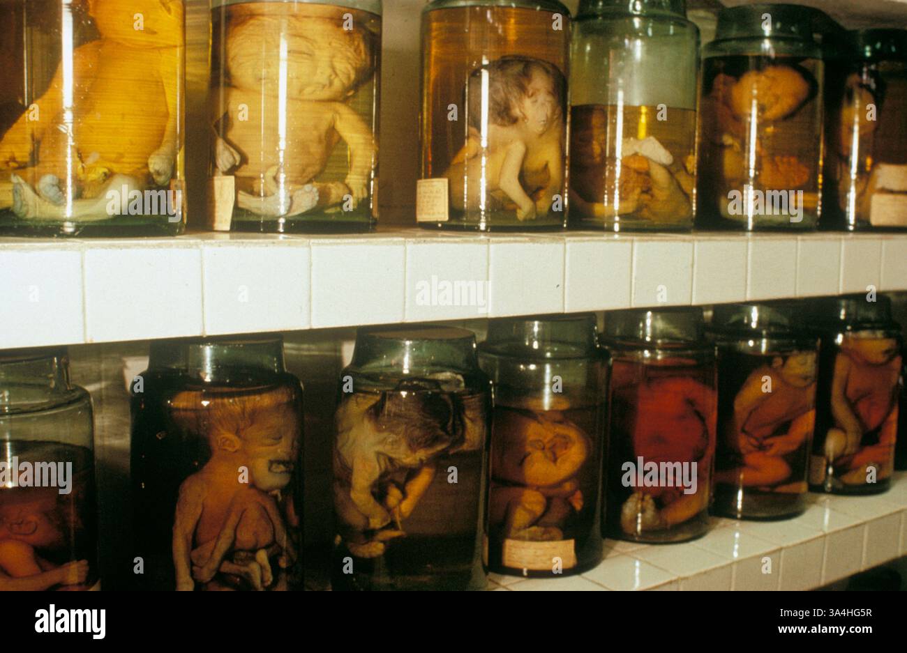 Mar 03, 1989; Saigon, VIETNAM; (FILE PHOTO) Mutated specimens of ...