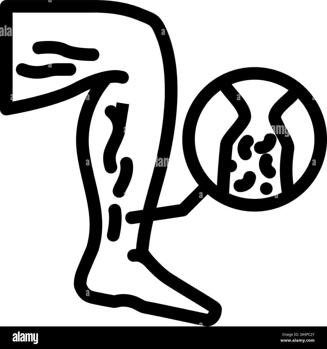 deep vein thrombosis cardiology disease line icon vector illustration ...