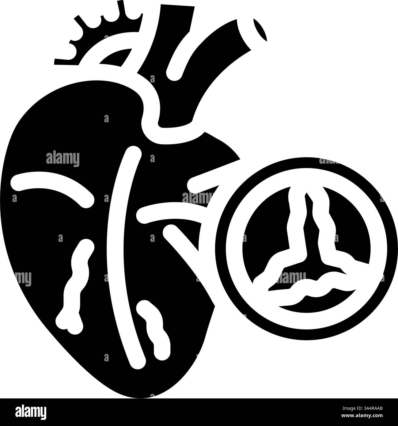 heart valve disease cardiology disease glyph icon vector illustration ...