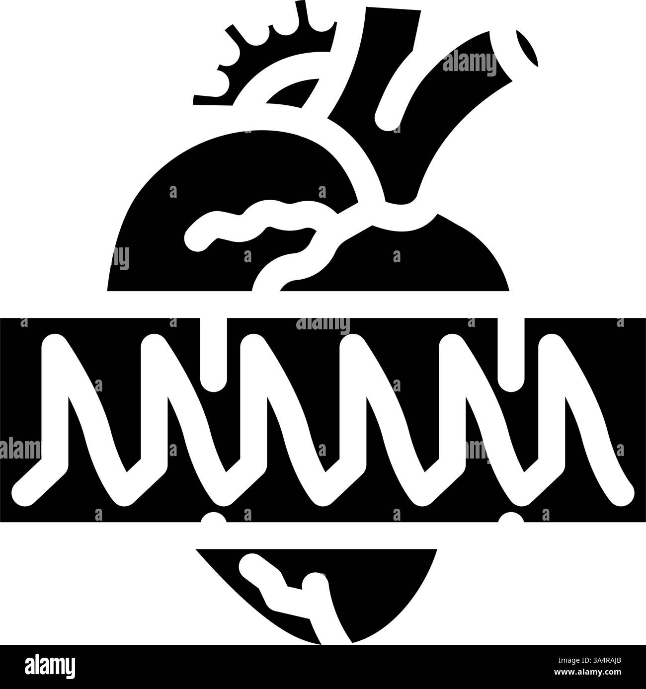 Ventricular flutter Black and White Stock Photos & Images - Alamy