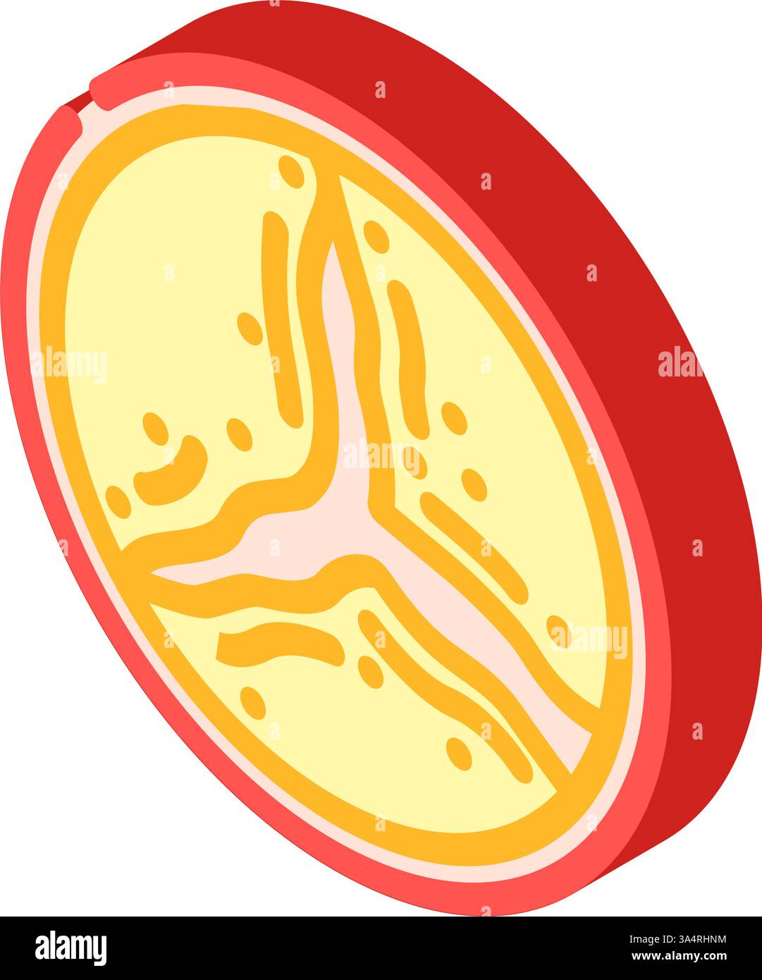 aortic stenosis cardiology disease isometric icon vector illustration Stock Vector Image & Art ...
