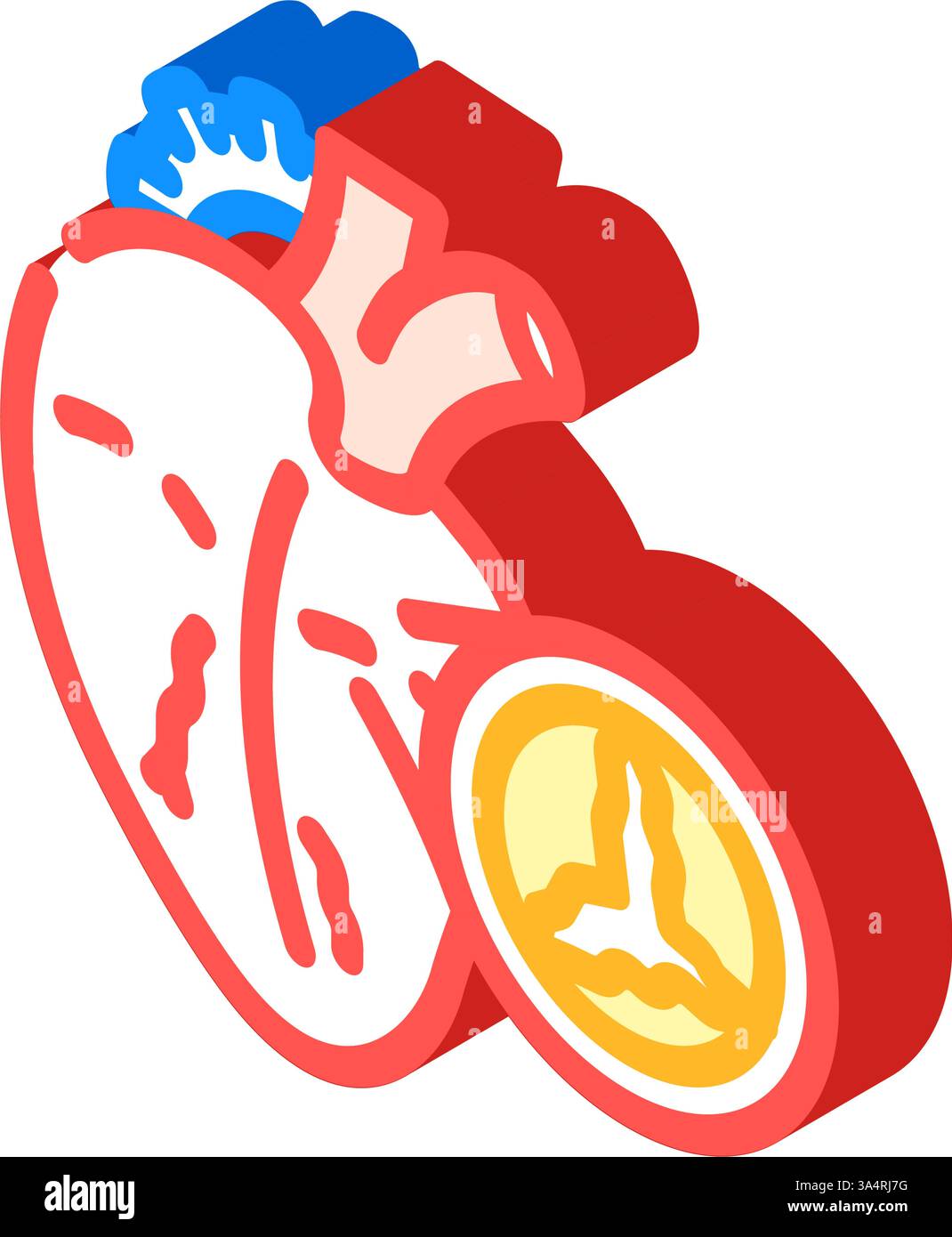 heart valve disease cardiology disease isometric icon vector ...