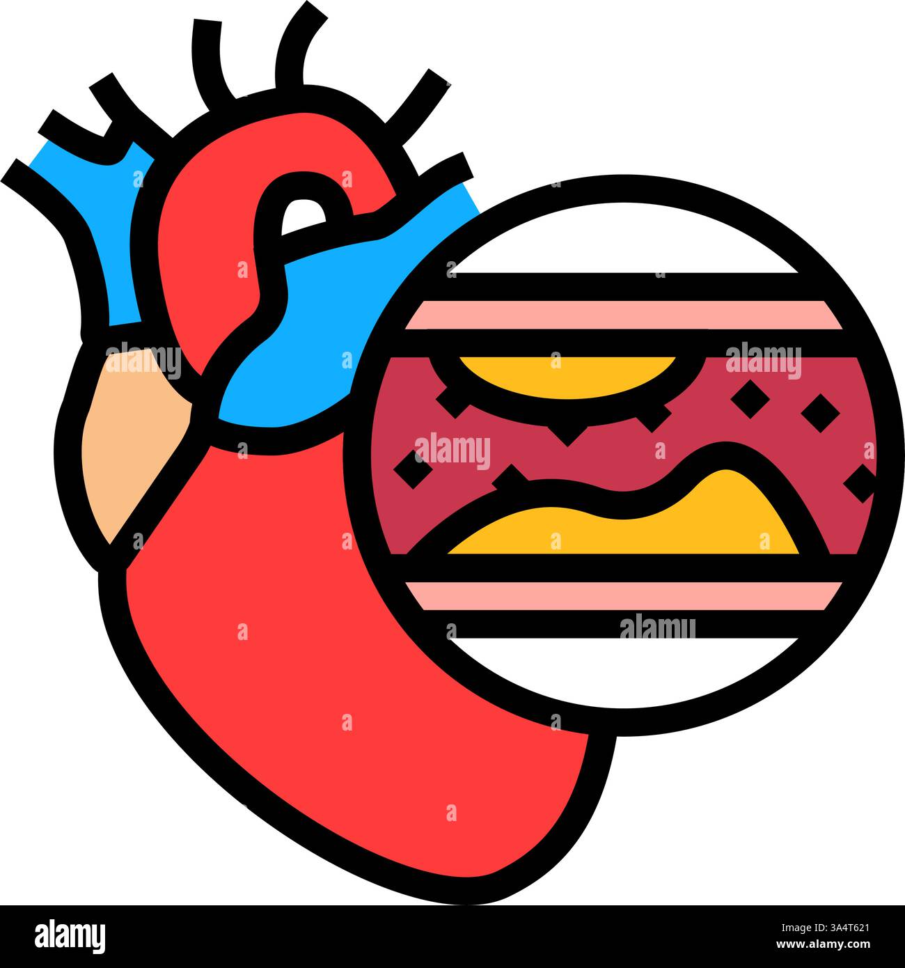 Atherosclerosis Cardiology Disease Color Icon Vector Illustration Stock Vector Image And Art Alamy