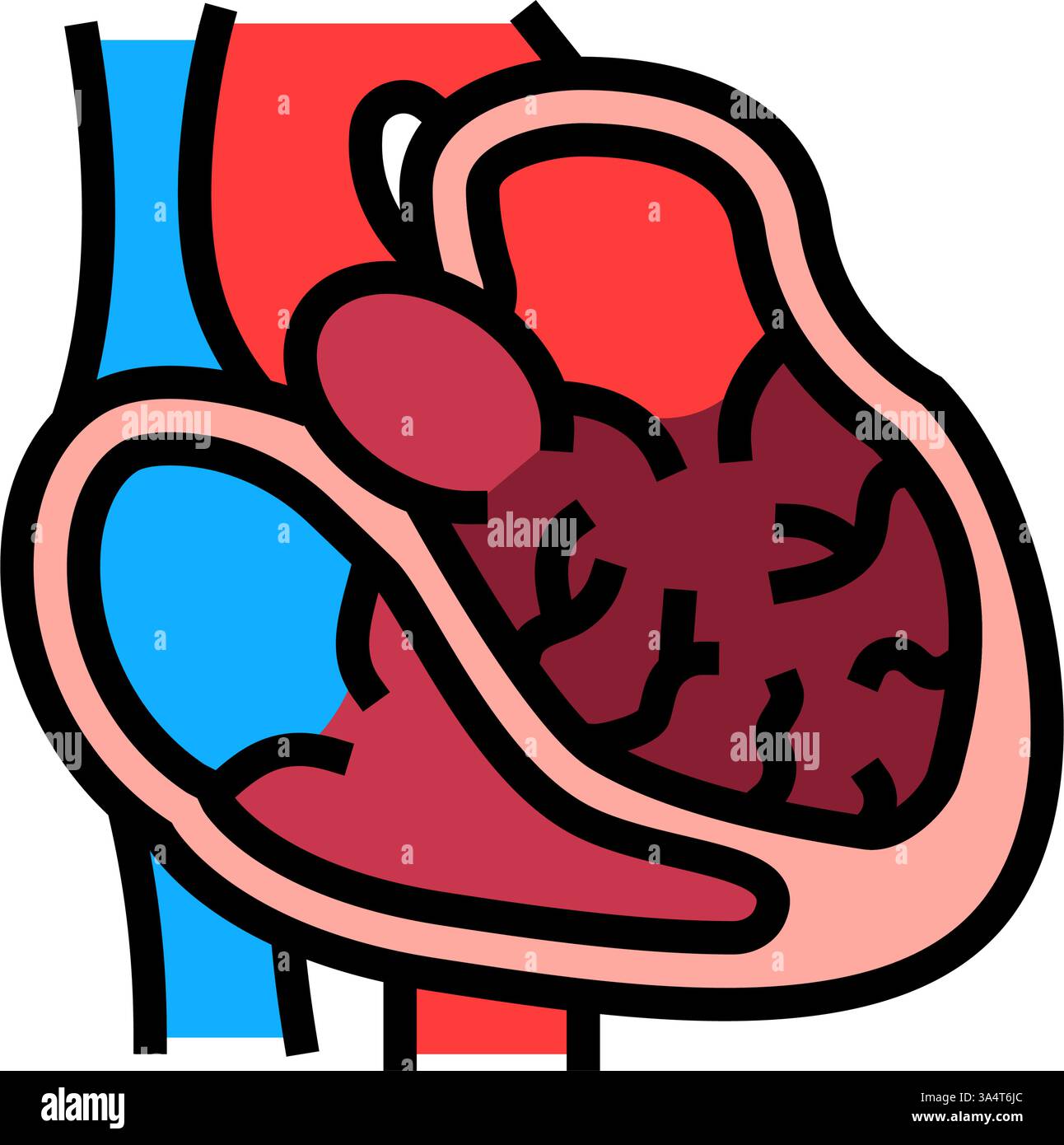 dilated cardiomyopathy cardiology disease color icon vector ...