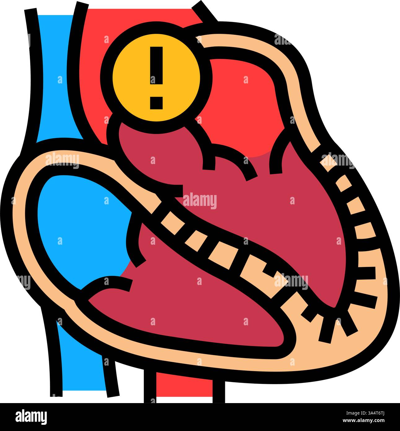 restrictive cardiomyopathy cardiology color icon vector illustration ...