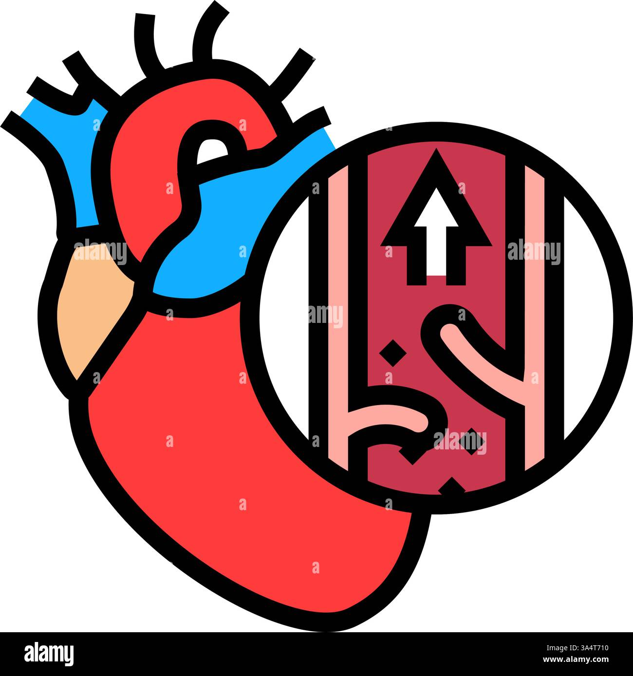 mitral valve prolaps cardiology disease color icon vector illustration Stock Vector Image & Art ...