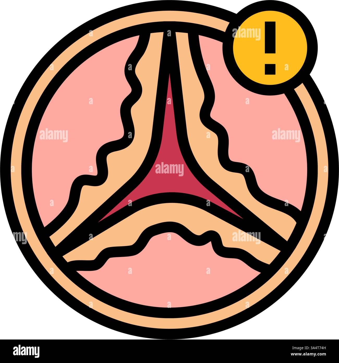 aortic stenosis cardiology disease color icon vector illustration Stock Vector Image & Art - Alamy