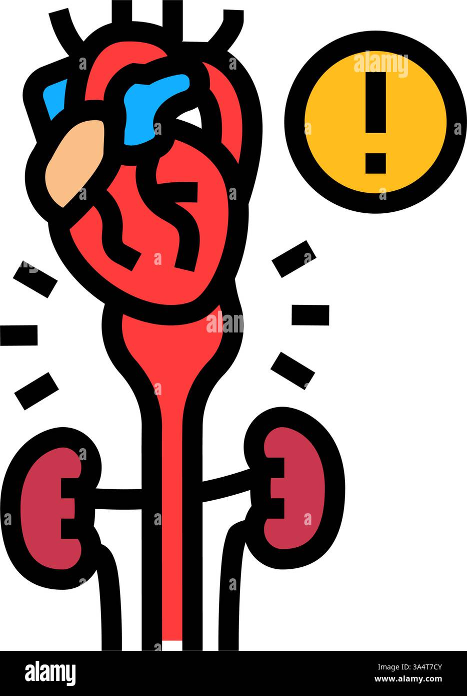 aortic aneurysm cardiology disease color icon vector illustration Stock ...