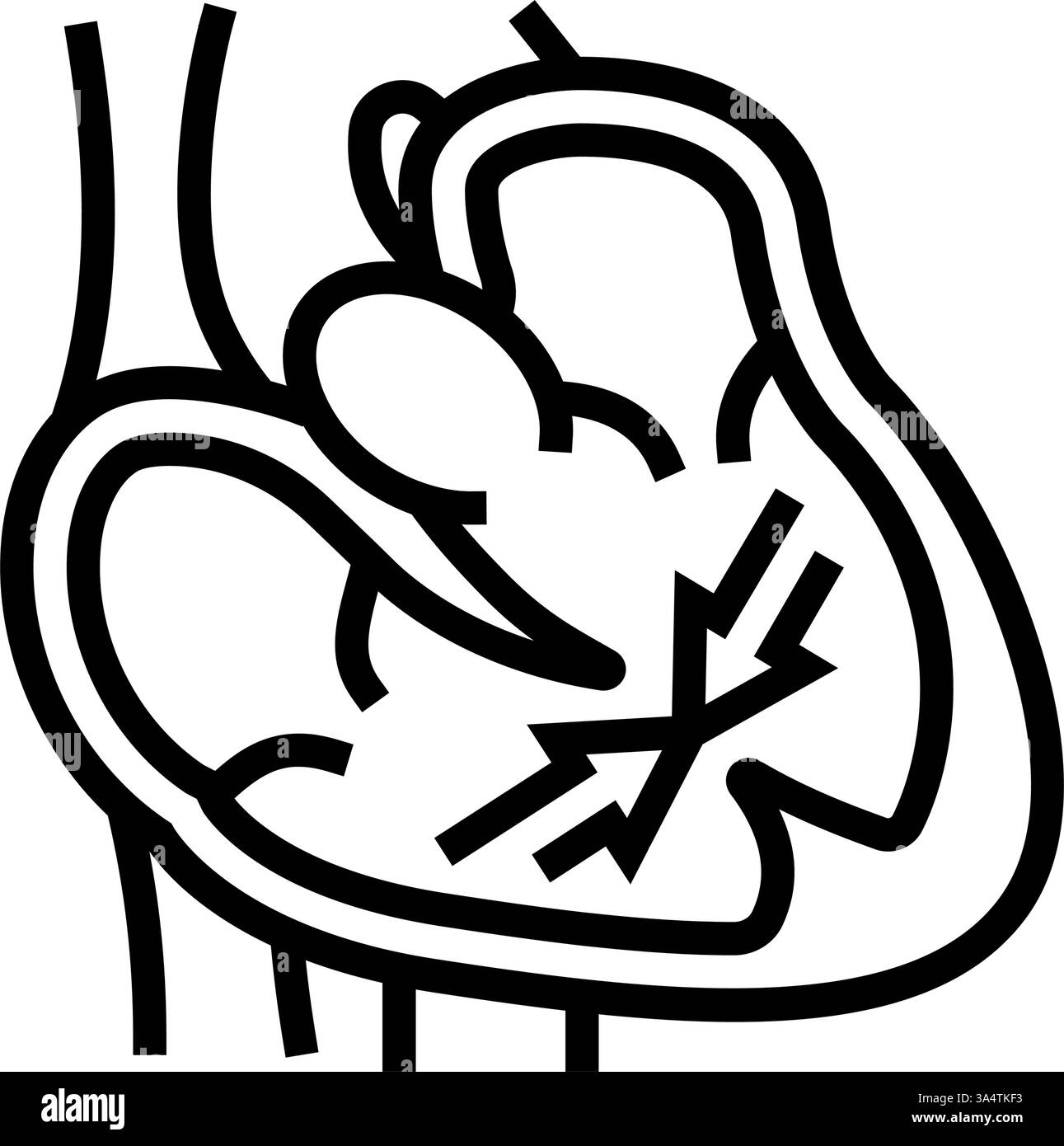 cardiomyopathy cardiology disease line icon vector illustration Stock ...