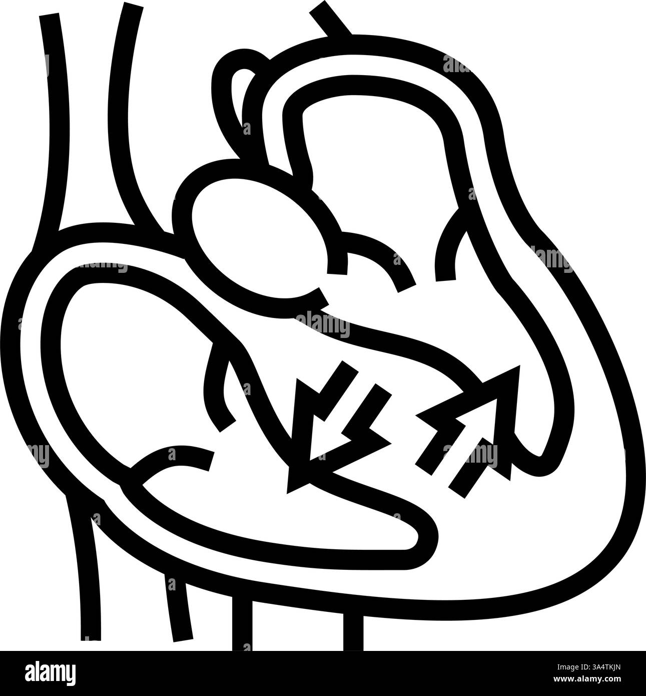 hypertrophic cardiomyopathy cardiology line icon vector illustration ...