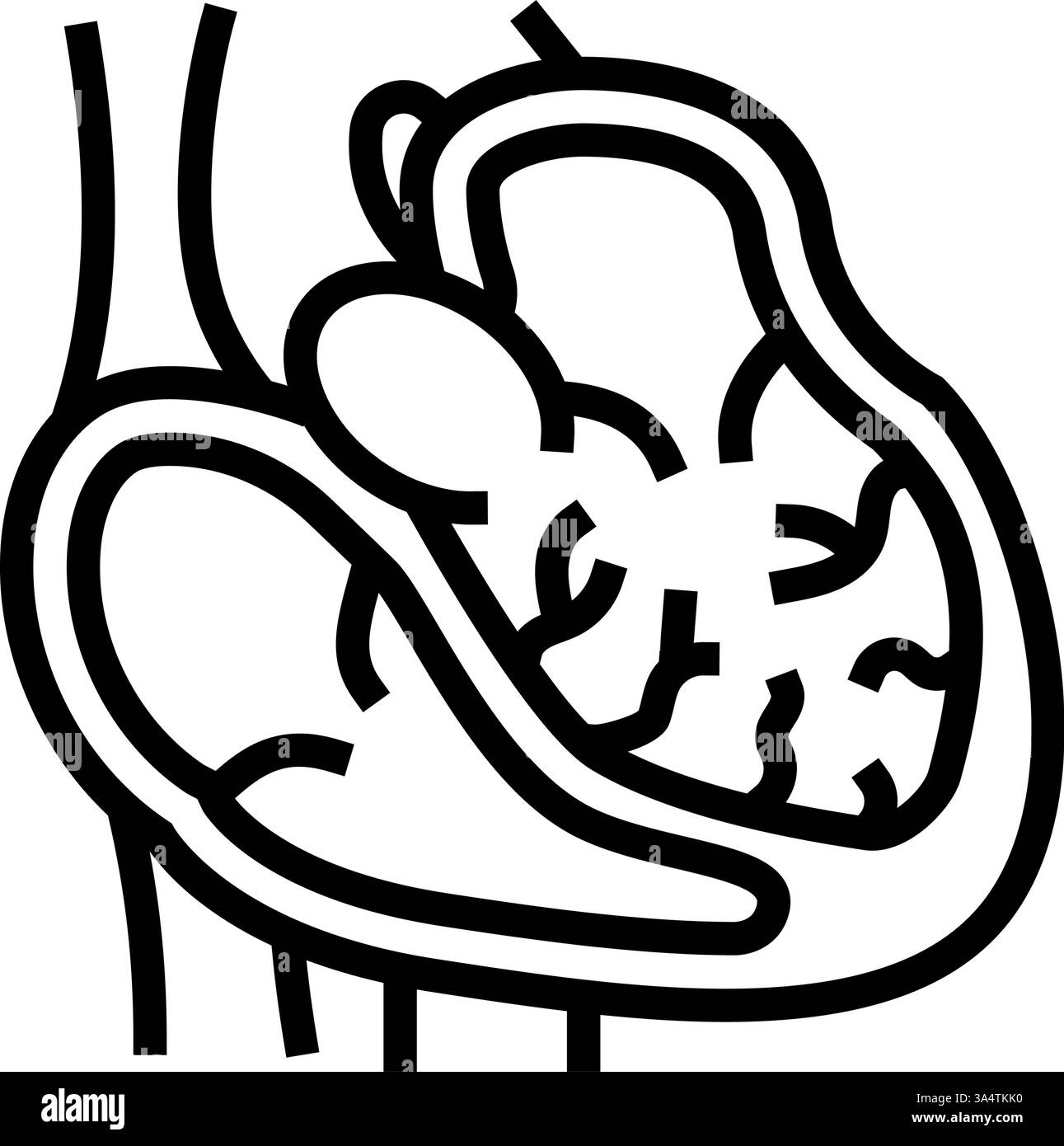 dilated cardiomyopathy cardiology disease line icon vector illustration ...