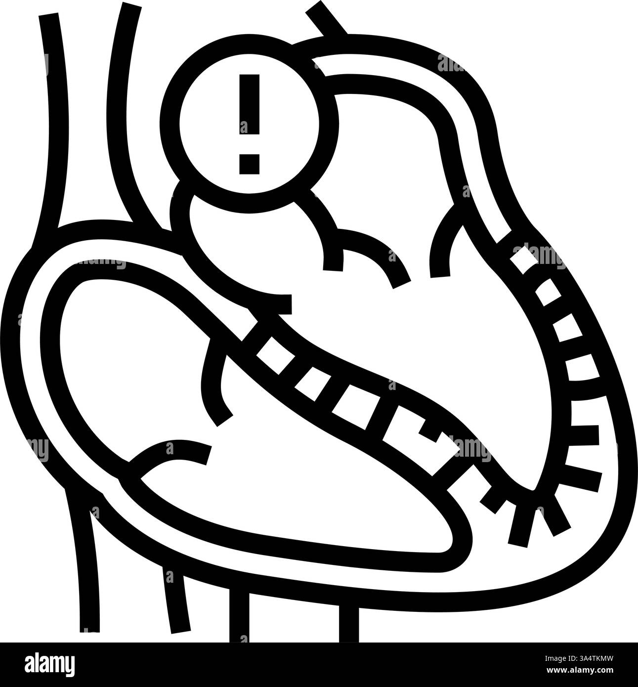 restrictive cardiomyopathy cardiology line icon vector illustration ...