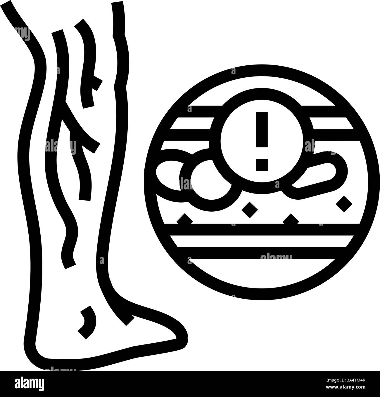 deep vein thrombosis cardiology disease line icon vector illustration ...